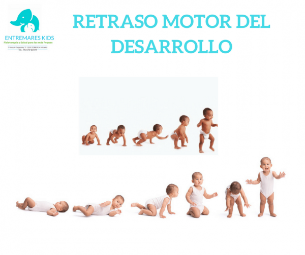 VALORACIÓN DEL BEBÉ: DESARROLLO MOTOR - Entremares Kids